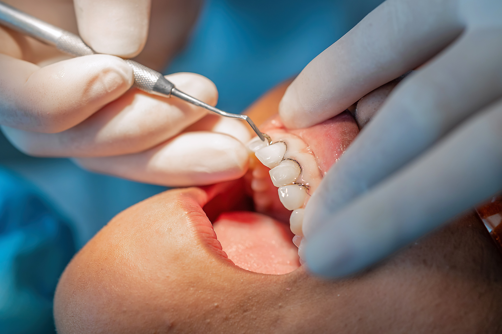 Academy of General Dentistry Submits Comments to Minnesota Dental Board ...